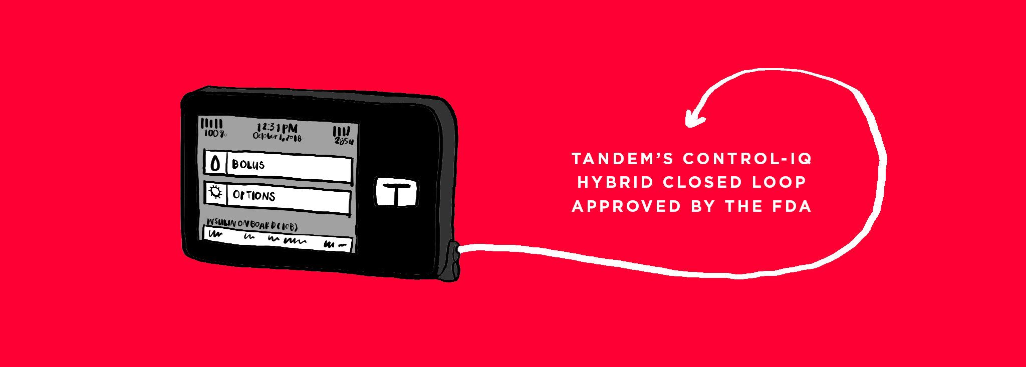Tandem’s Control-IQ Hybrid Closed Loop Approved by the FDA | Beyond Type 1