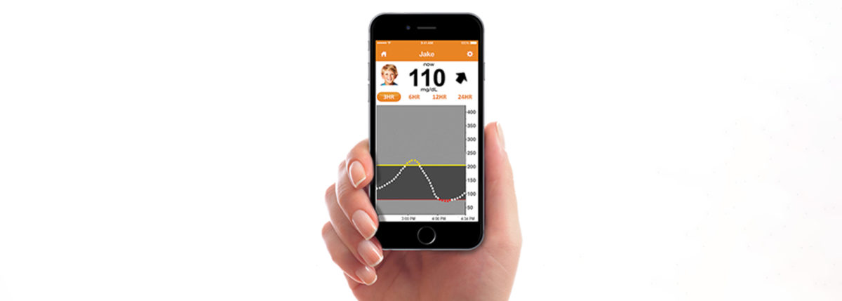 Dexcom Share | Beyond Type 1