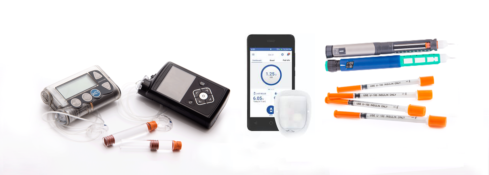 MDI vs Insulin Pumps in Type 2 Diabetes | Beyond Type 1