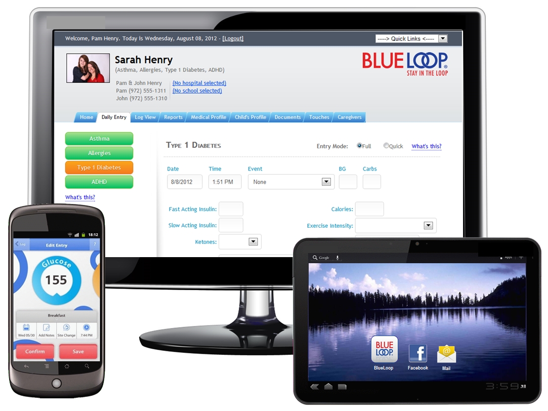 El sistema Blueloop para manejar mejor la diabetes tipo 1 en las ...